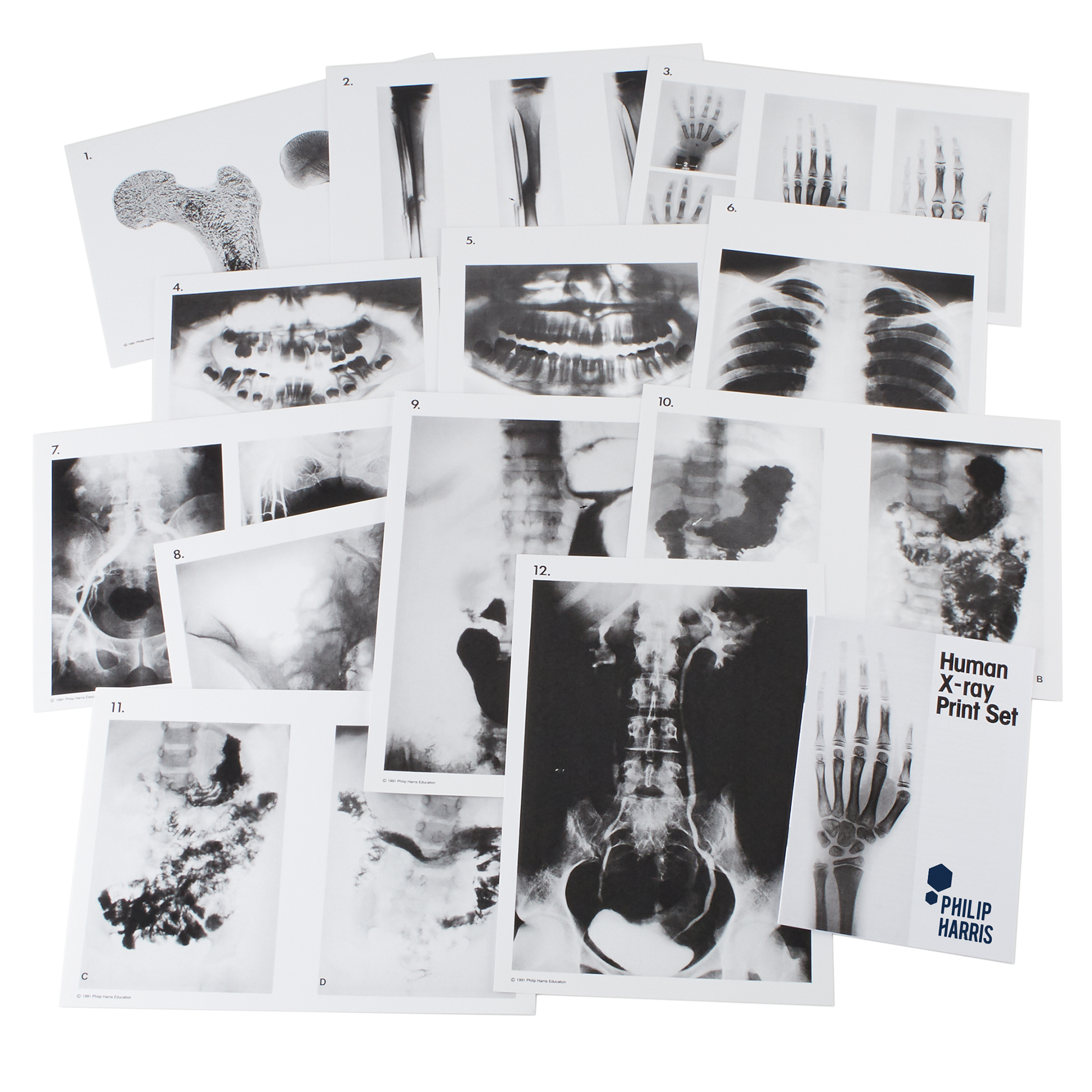 Human X-ray Print Set A4 | Eduspace Supplies