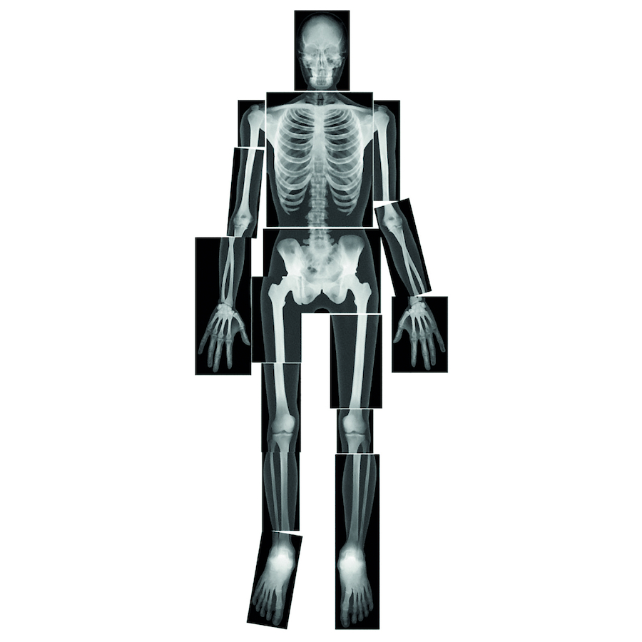 Child Size Human Body X Rays | Eduspace Supplies